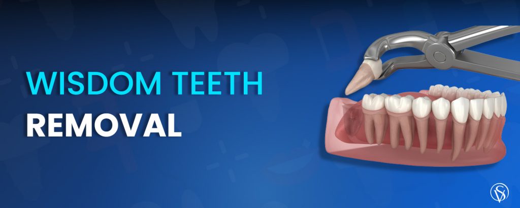 Wisdom Teeth Removal: Procedure, Cost, and Aftercare