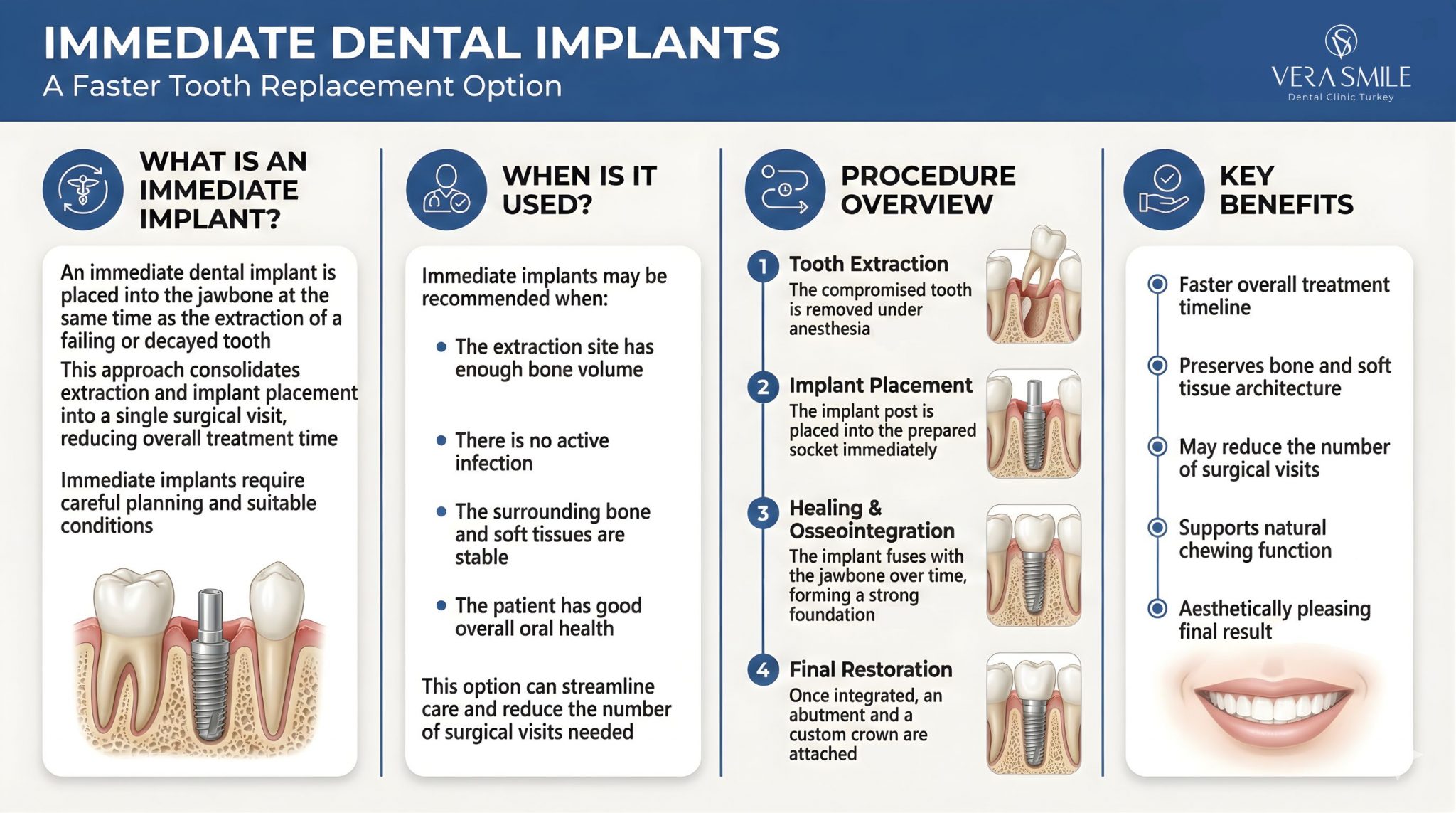 Immediate Dental Implants - Vera Smile