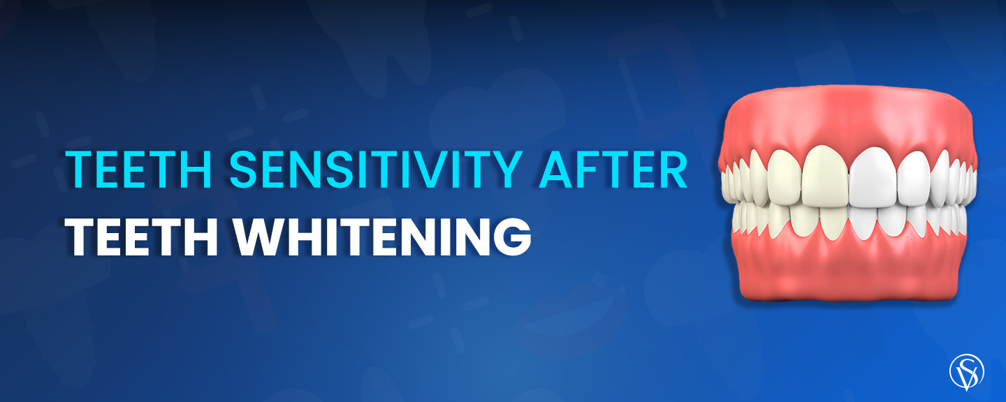 Teeth Sensitivity After Whitening: Causes, Longevity and Treatment