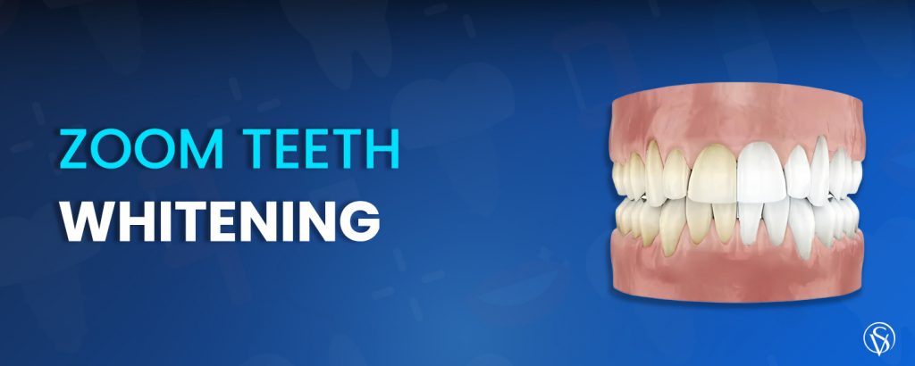Zoom Teeth Whitening: Cost, Process and Result